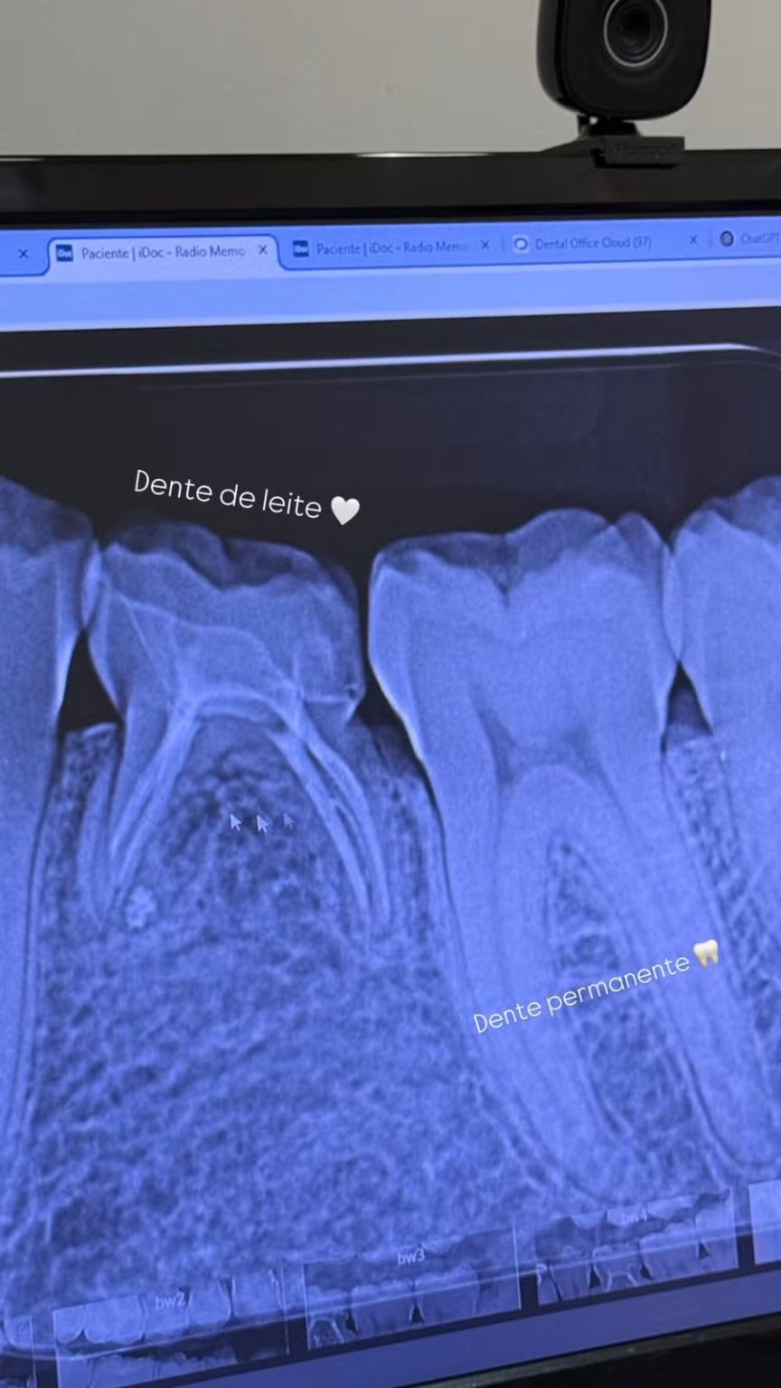 Larissa Manoela faz descoberta inusitada na boca; veja foto ... Larissa Manoela faz descoberta inusitada na boca; veja foto ...